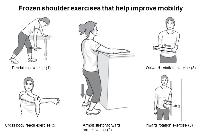 What Is Frozen Shoulder An Explainer For Africans